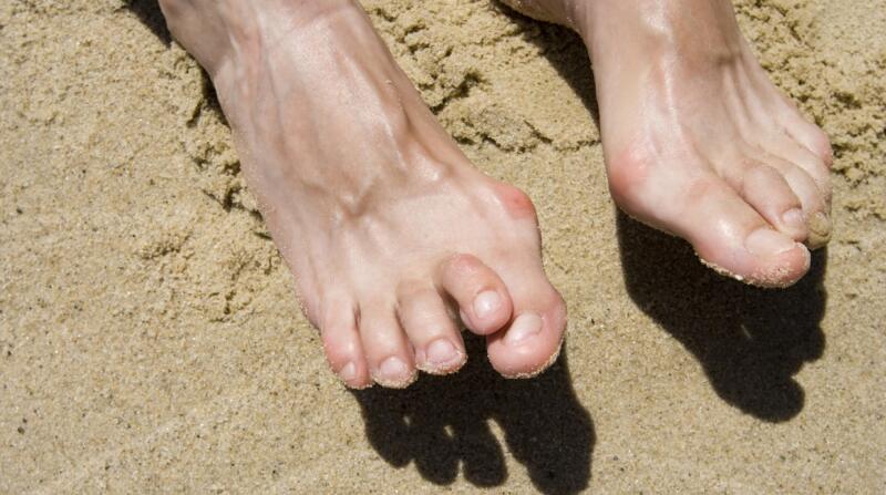 foot problems common