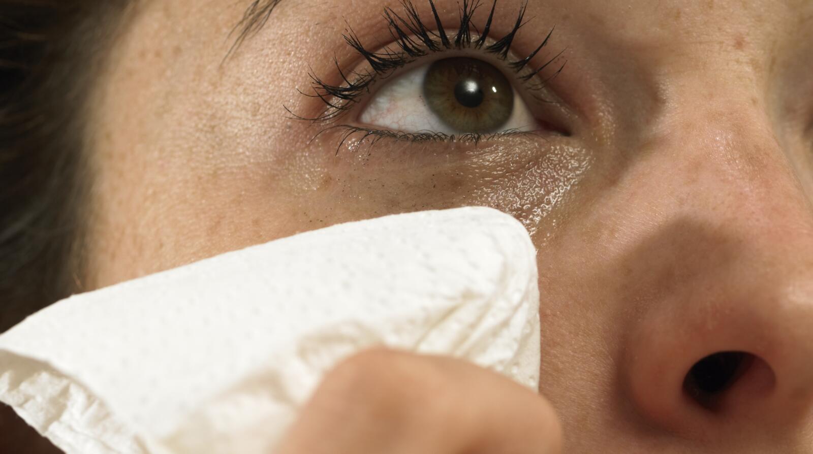 Types of Eye Discharge & What They Mean