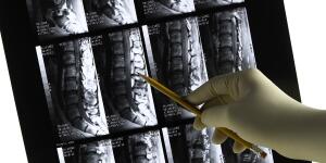 Most Painful Broken Bones