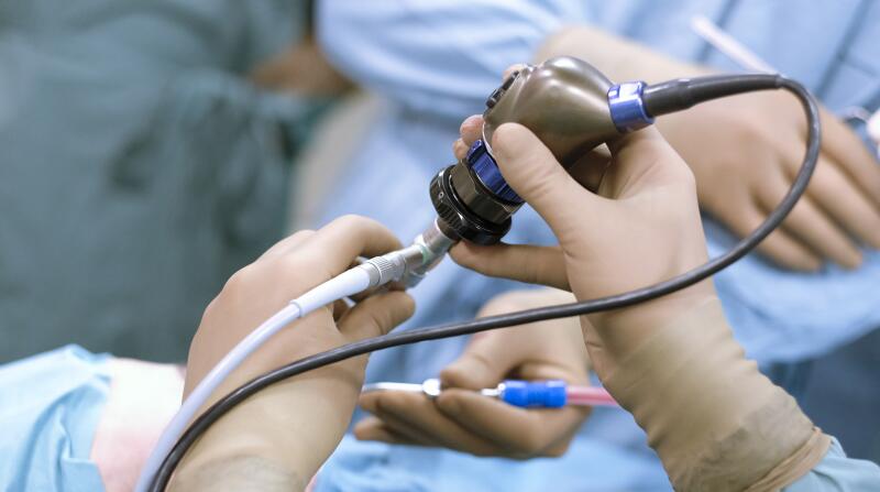 What Doctors Want You to Know About Kidney Removal