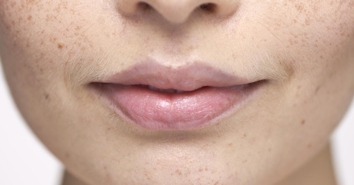 Mewing: What Is It and Does It Work? | How to Do Mewing Exercises