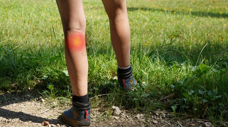 is cellulitis contagious