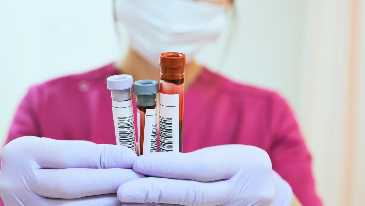 8 Things That Can Increase Your Blood Platelet Count