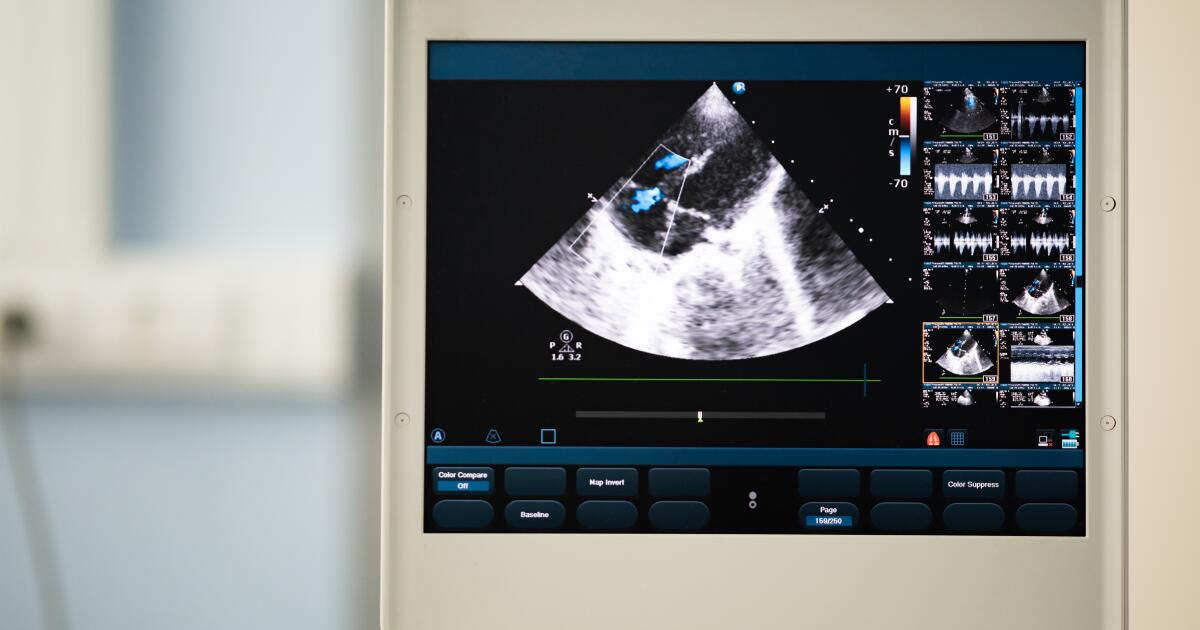Doppler Ultrasound Test: Why It's Done, Risks, What to Expect