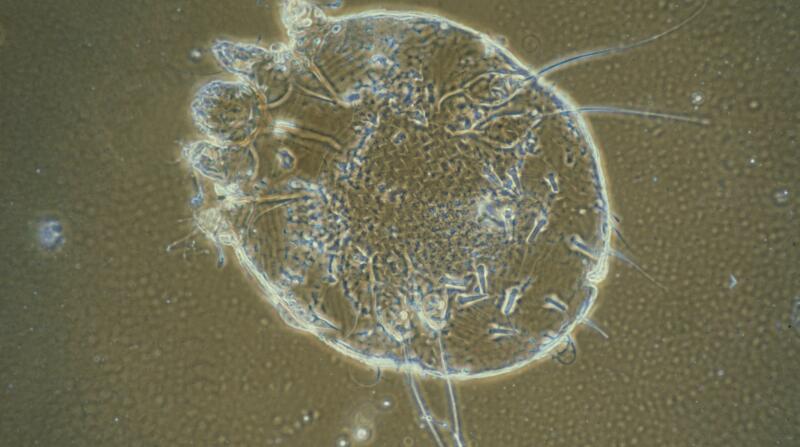 scabies bug under microscope