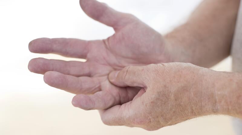 Dupuytren's Contracture: 10 Things Doctors Want You to Know