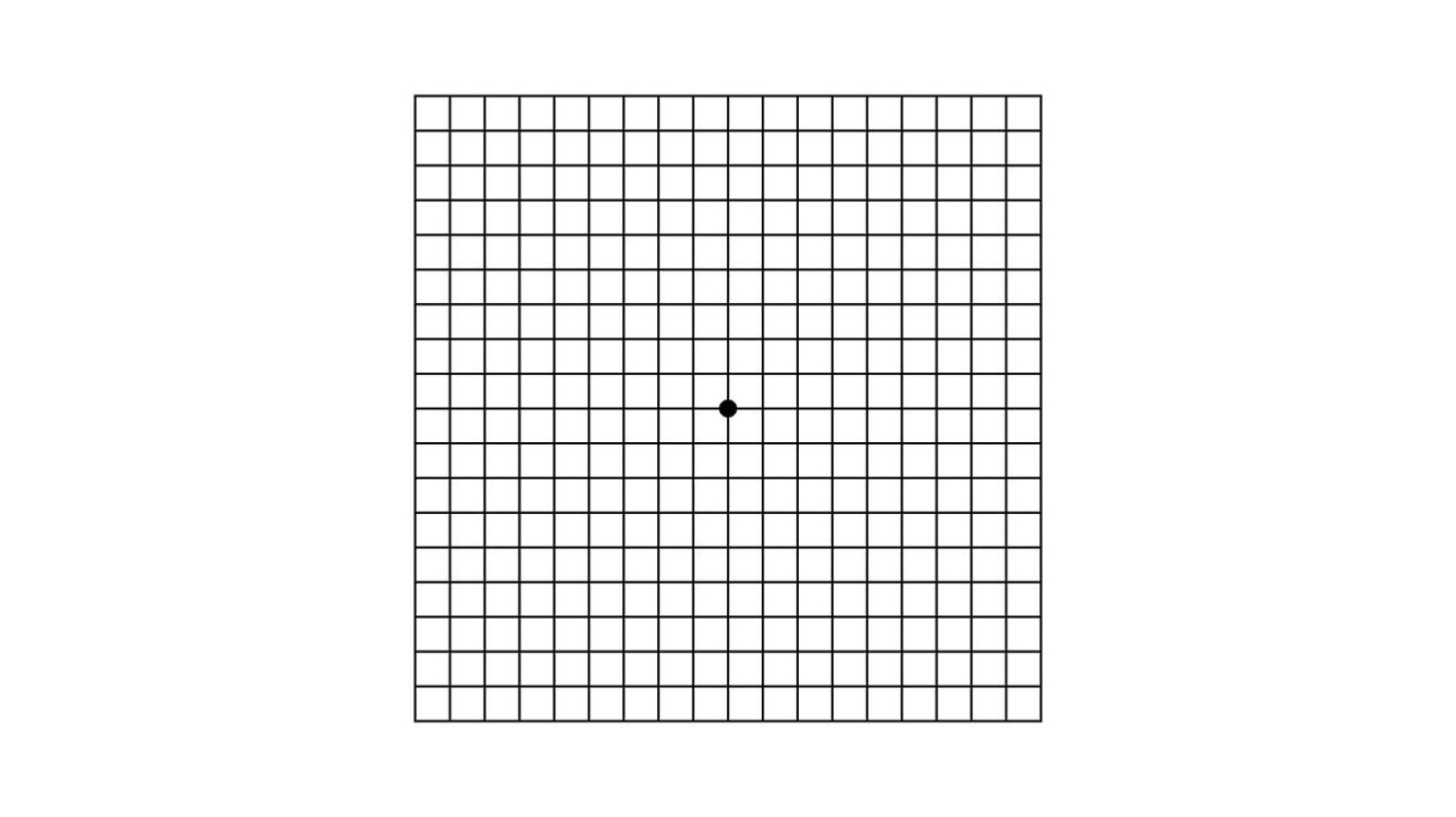 Amsler Grid Test: How to Use, Results, and Related Conditions