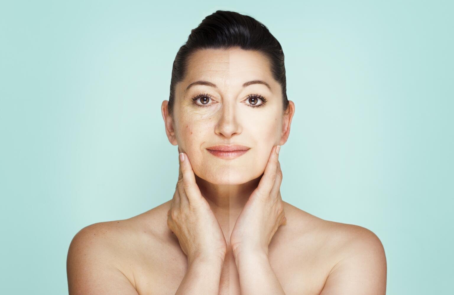Neck Lift Surgery & Recovery | What to Expect After a Neck Lift