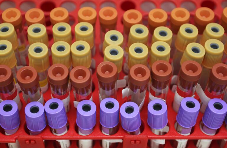 Blood Types and How They Affect Your Health