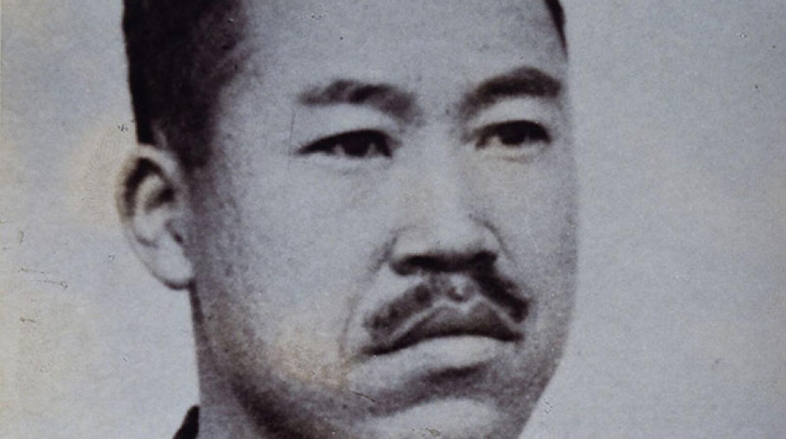 7 Surprising Facts About Hashimoto's Disease