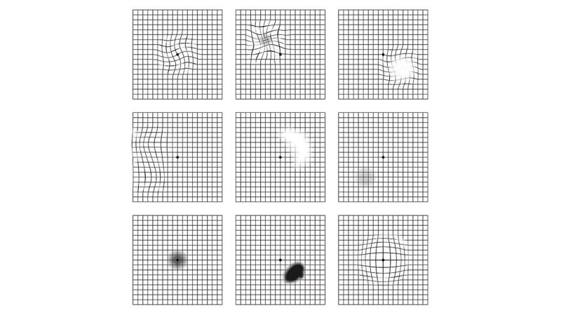 Amsler Grid Test: How to Use, Results, and Related Conditions