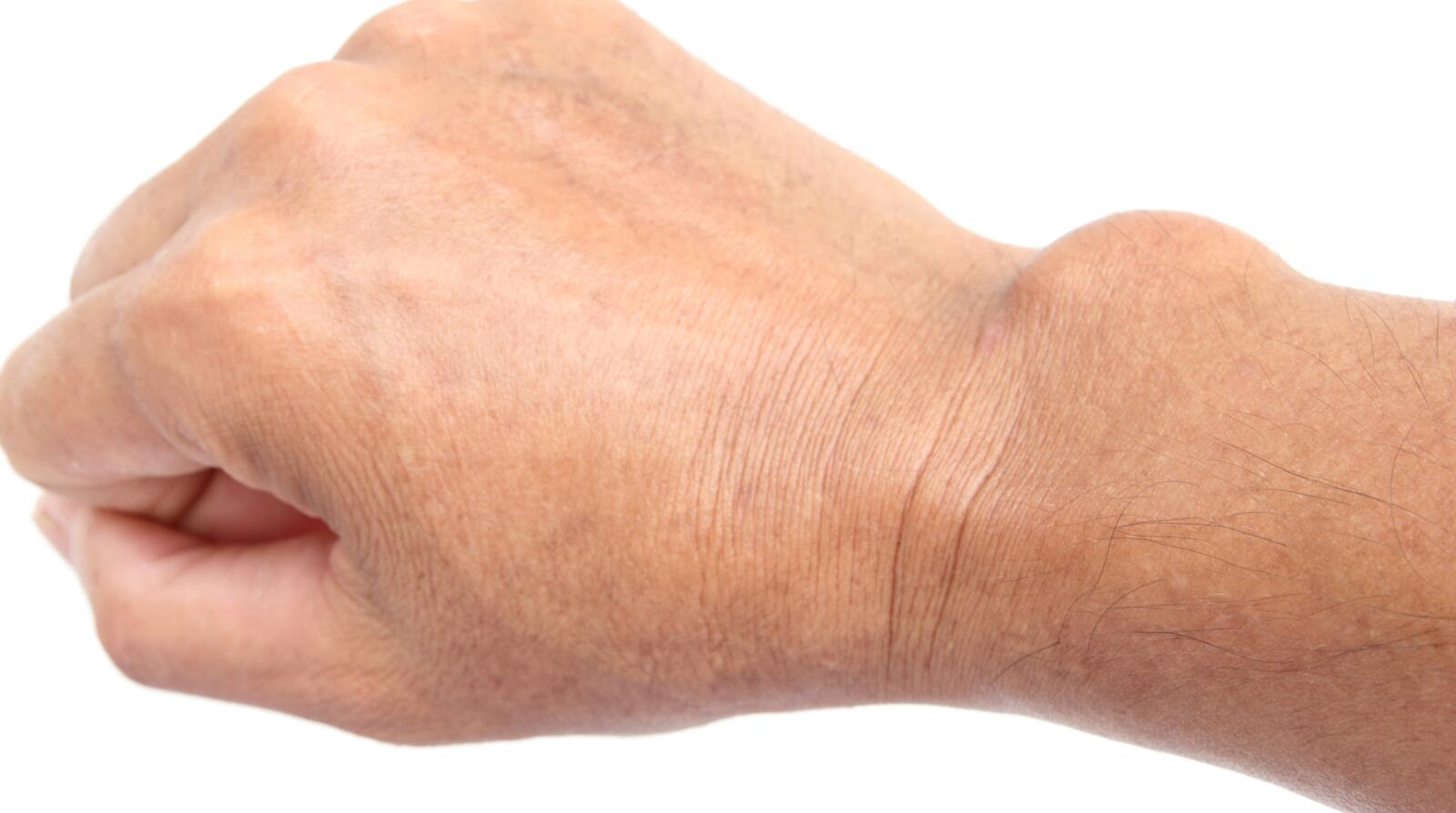 Why Does My Wrist Hurt? | Common Wrist Pain Causes