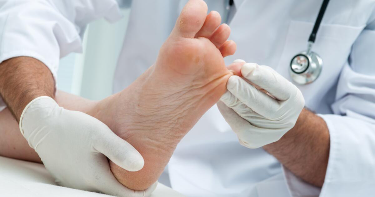 Foot Lump - Symptoms, Causes, Treatments