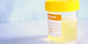 5 Fast Facts About Urine
