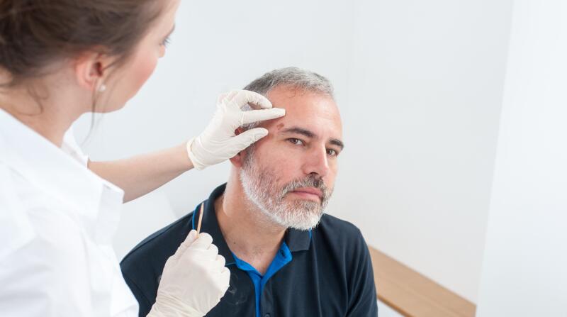 10 Tips to Prepare for Mohs Surgery