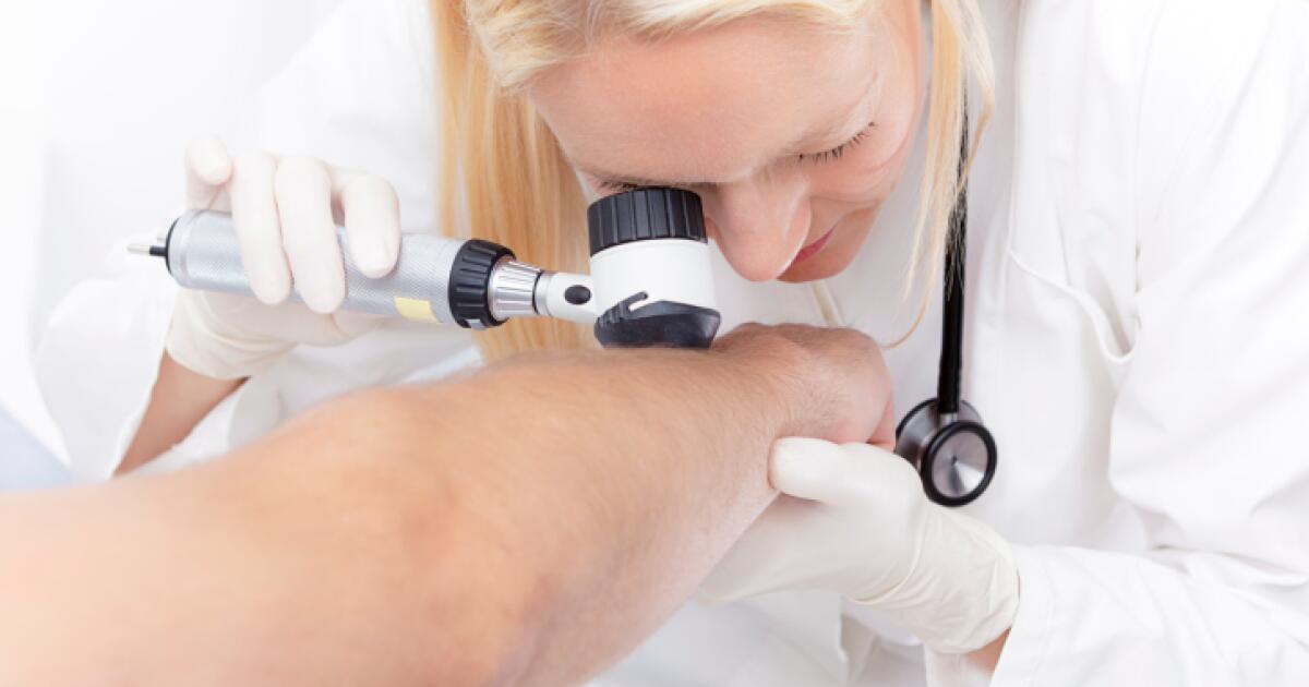 Sebaceous Cyst - Symptoms, Causes, Treatments