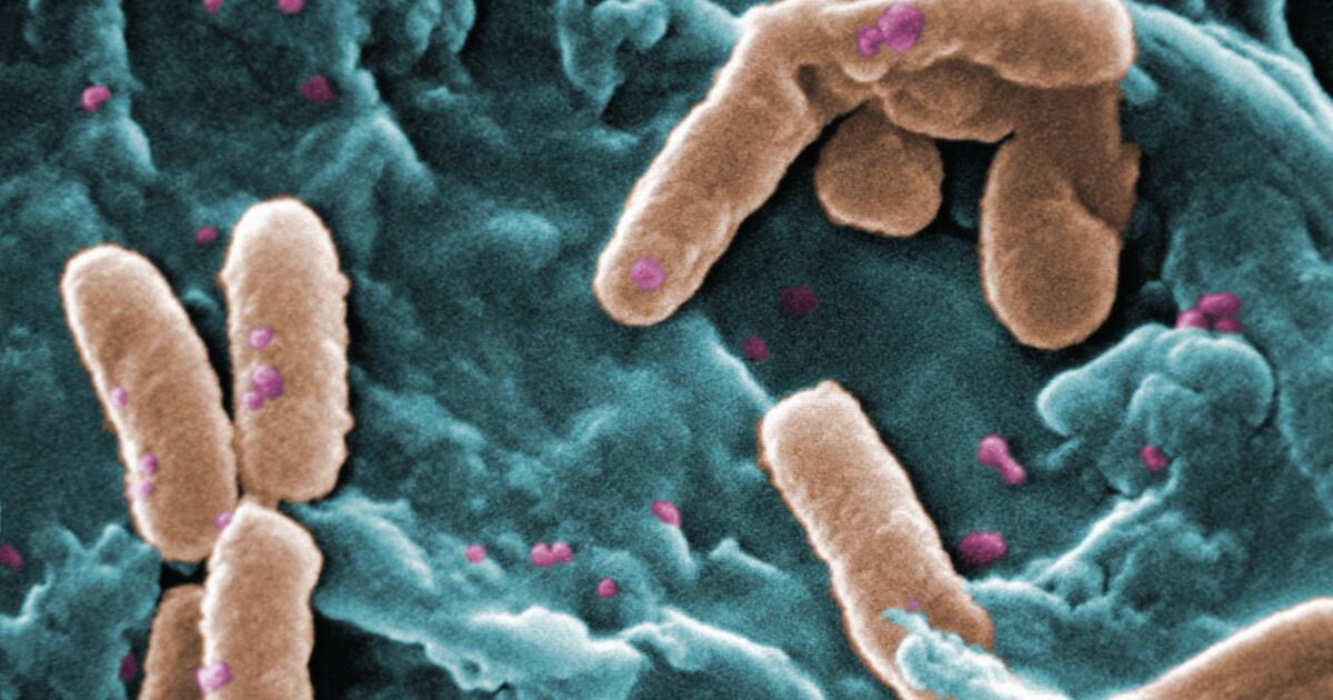 Pseudomonas Infection: Symptoms & Treatment | P. aeruginosa & P ...