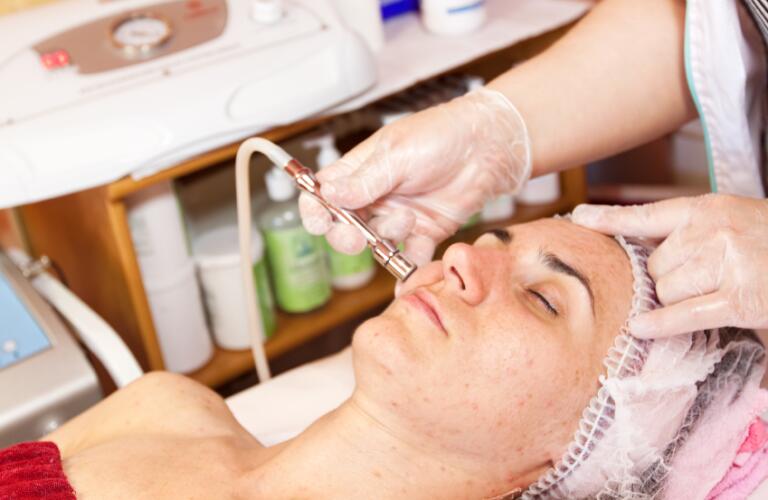 What to Expect After Dermabrasion Treatment