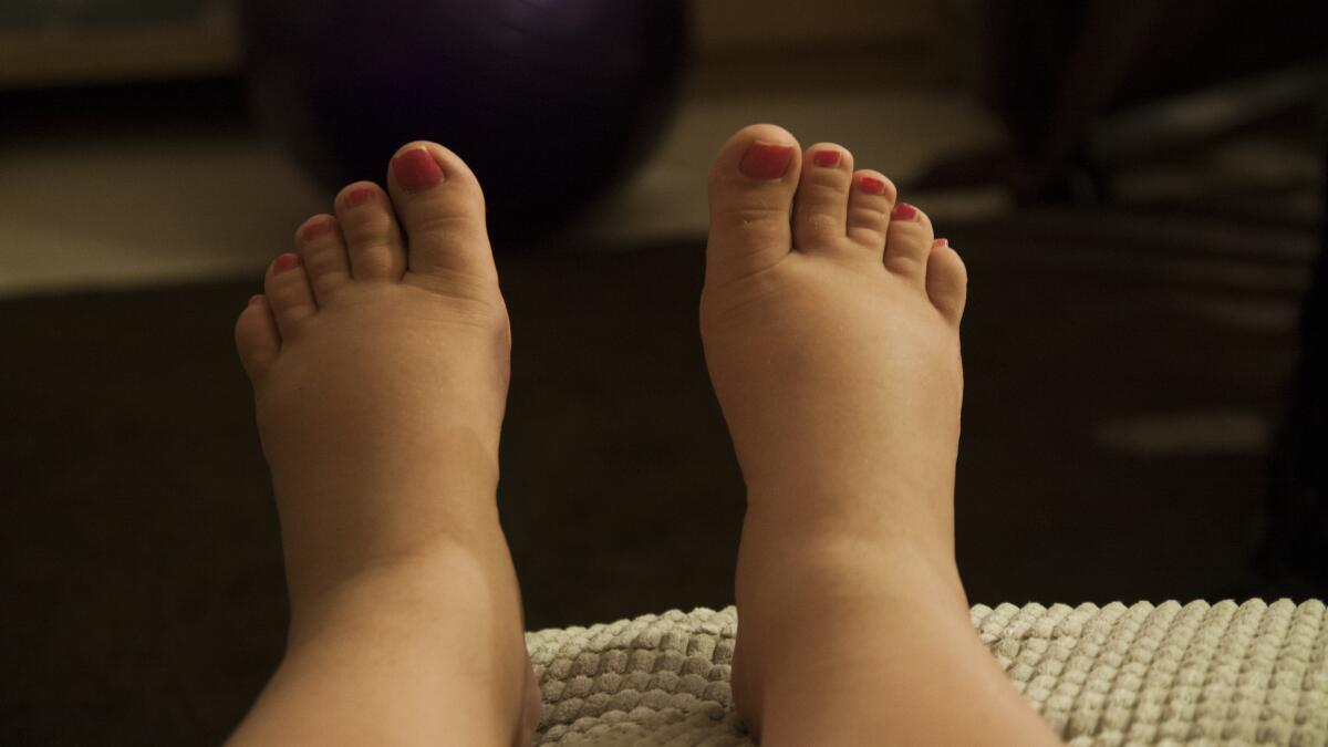 swollen ankles causes
