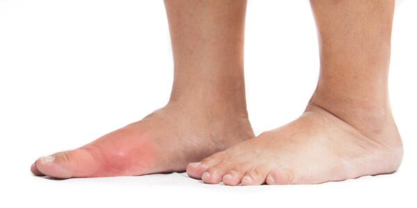 7 Common Causes of Big Toe Pain