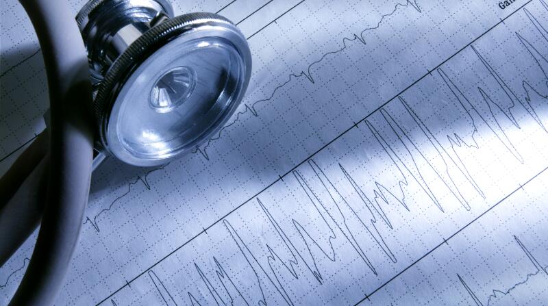 8 Things to Know About Cardioversion