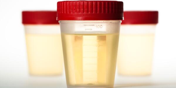 5 Fast Facts About Urine