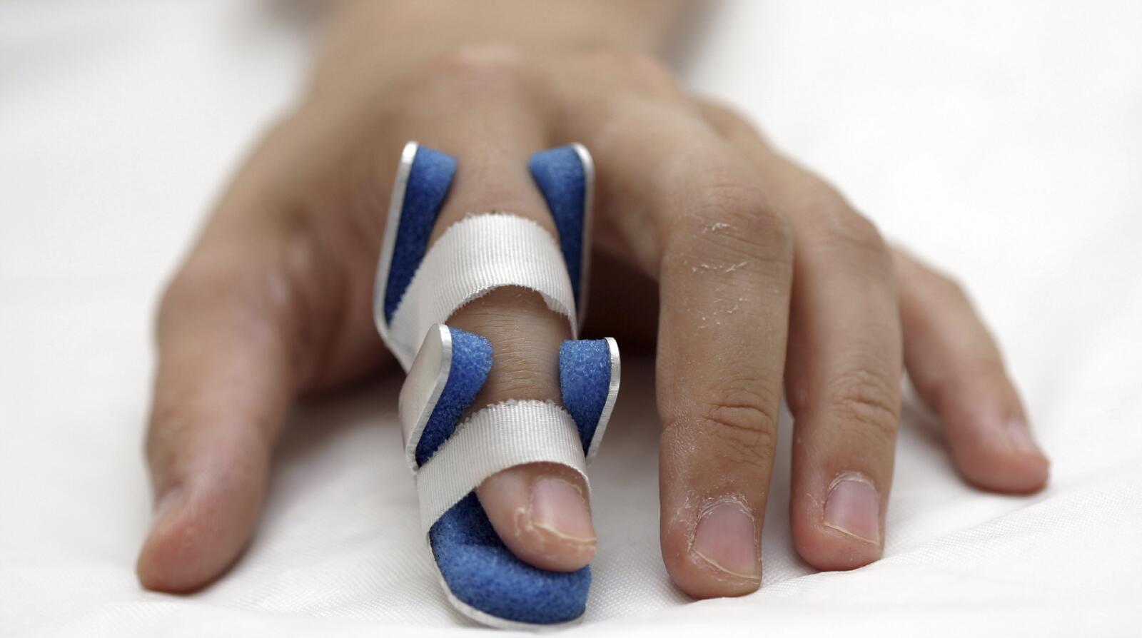 6 Common Fireworks-Related Injuries