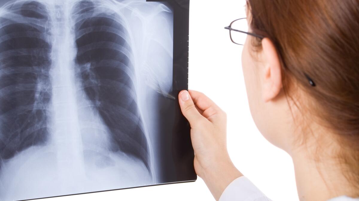 can you see bronchitis in a chest x ray