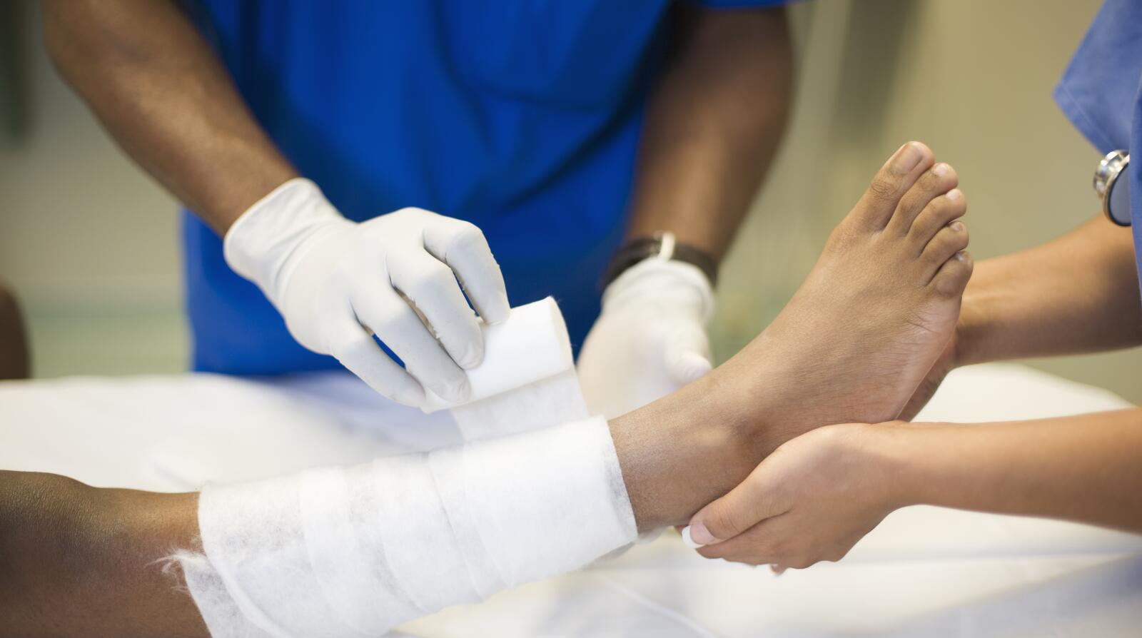 9 Things to Know About Pulmonary Embolism (PE) Symptoms & Treatment
