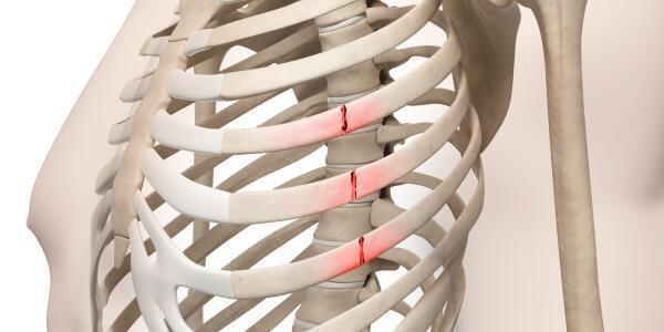 10 Most Painful Sports Injuries: Torn ACL, Hamstring Pull & More