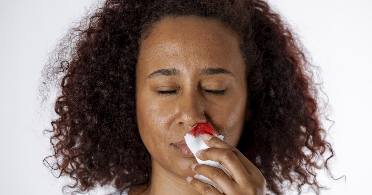 When to See a Doctor for Nosebleed Treatment