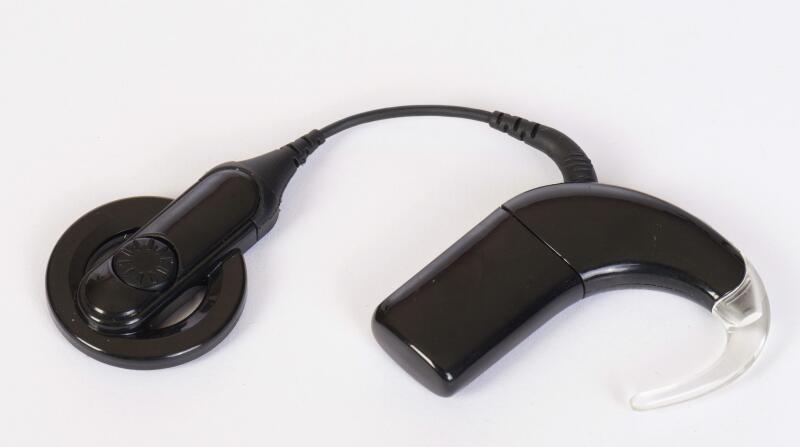 10 Surprising Cochlear Implant Facts | Cochlear Implant Surgery & Cost