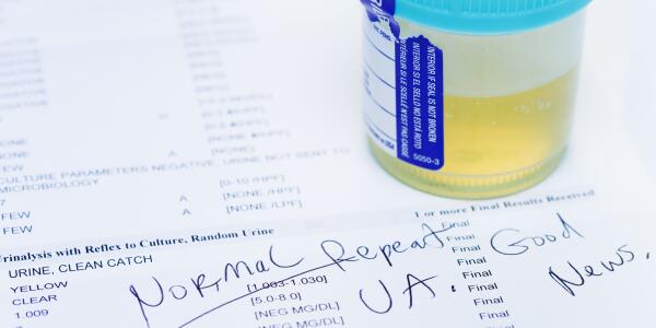 5 Fast Facts About Urine