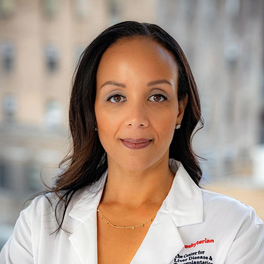 Dr. Alyson Fox, MD – Gastroenterologist for Hepatitis C in New York, NY