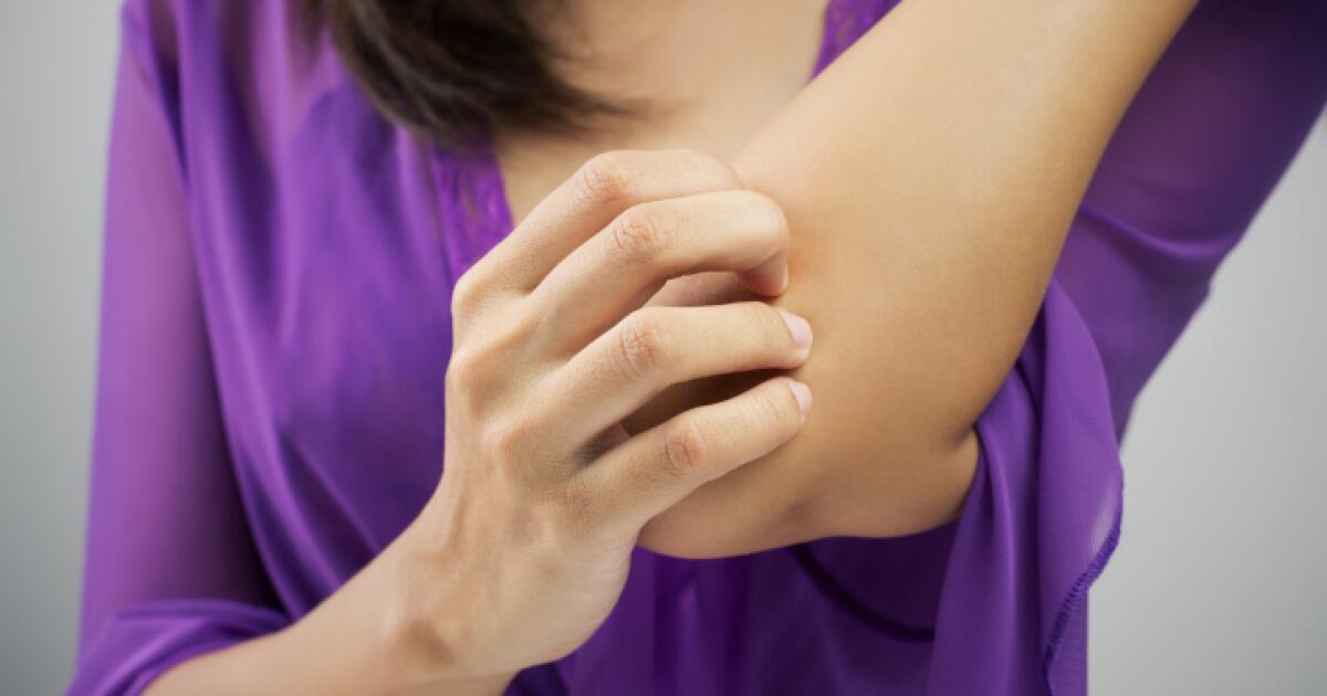 Itching Skin Itchy Skin Skin Rash Symptoms Causes Treatments Diagnosis