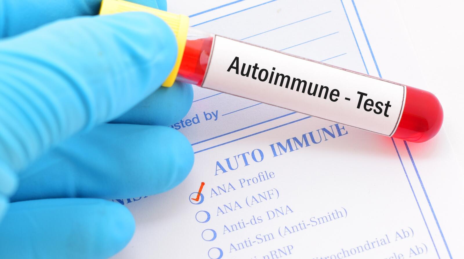 Morphea Facts | 5 Things to Know About Morphea