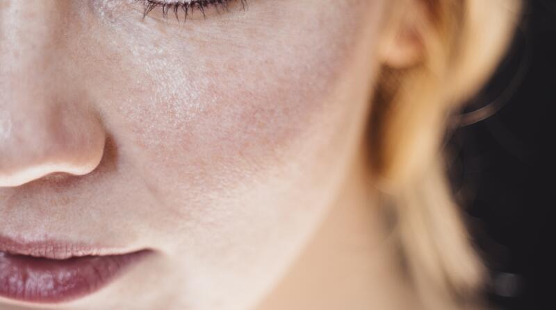 10 Reasons to See a Dermatologist