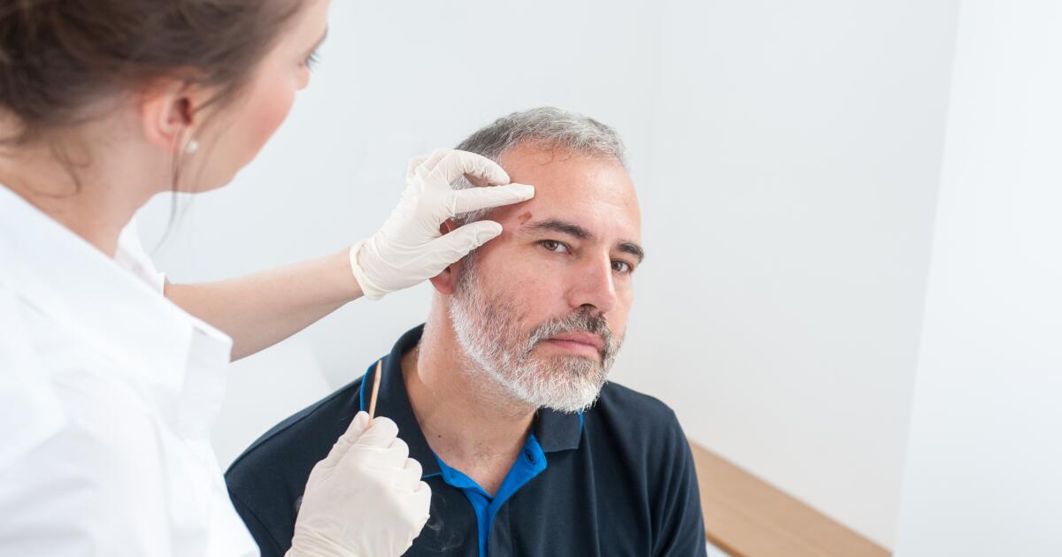 10 Tips to Prepare for Mohs Surgery