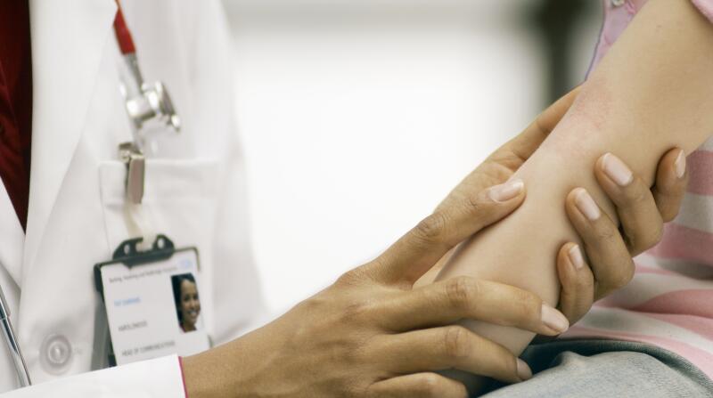 10 Things to Know About Scabies | Skin Mites