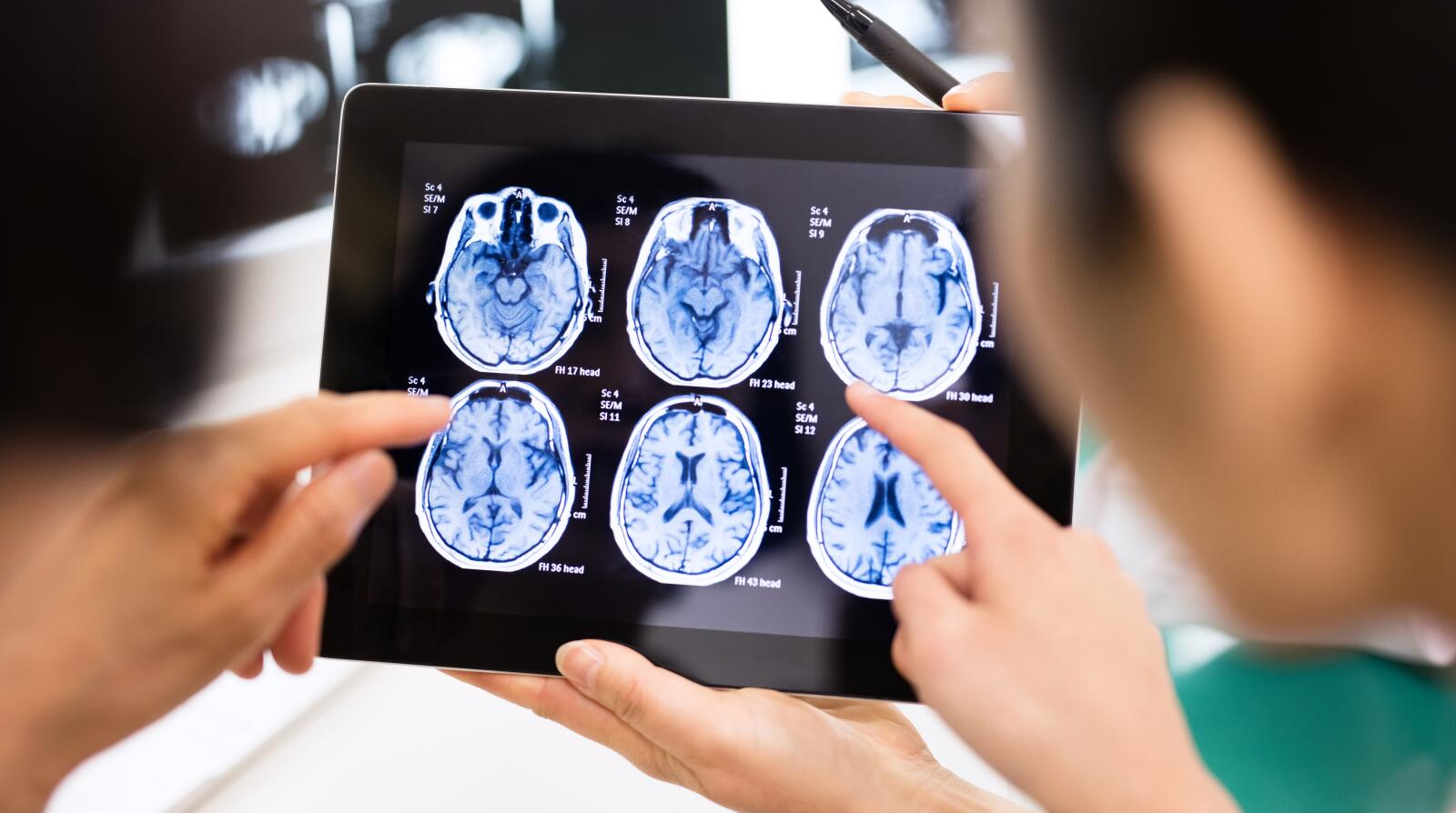 Why Do I Need an Echocardiogram?