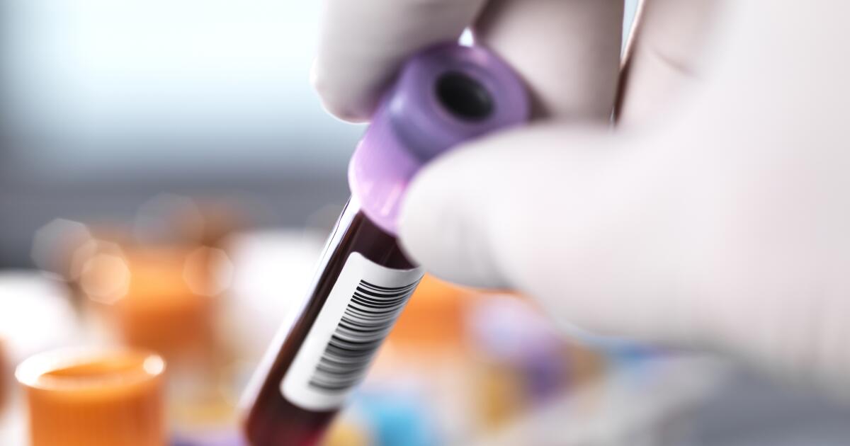 How Doctors Diagnose NASH | NASH Diagnostic Criteria