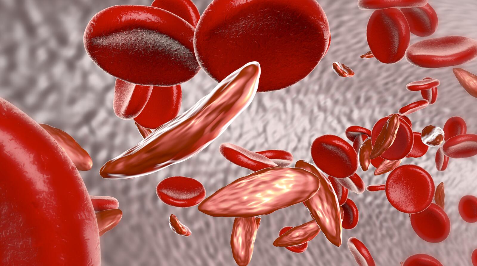 Anemia: 9 Things Doctors Want You to Know