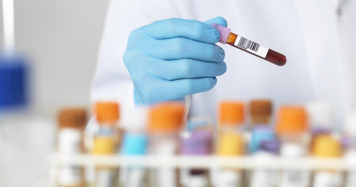 High Blood Calcium - Symptoms, Causes, Treatments