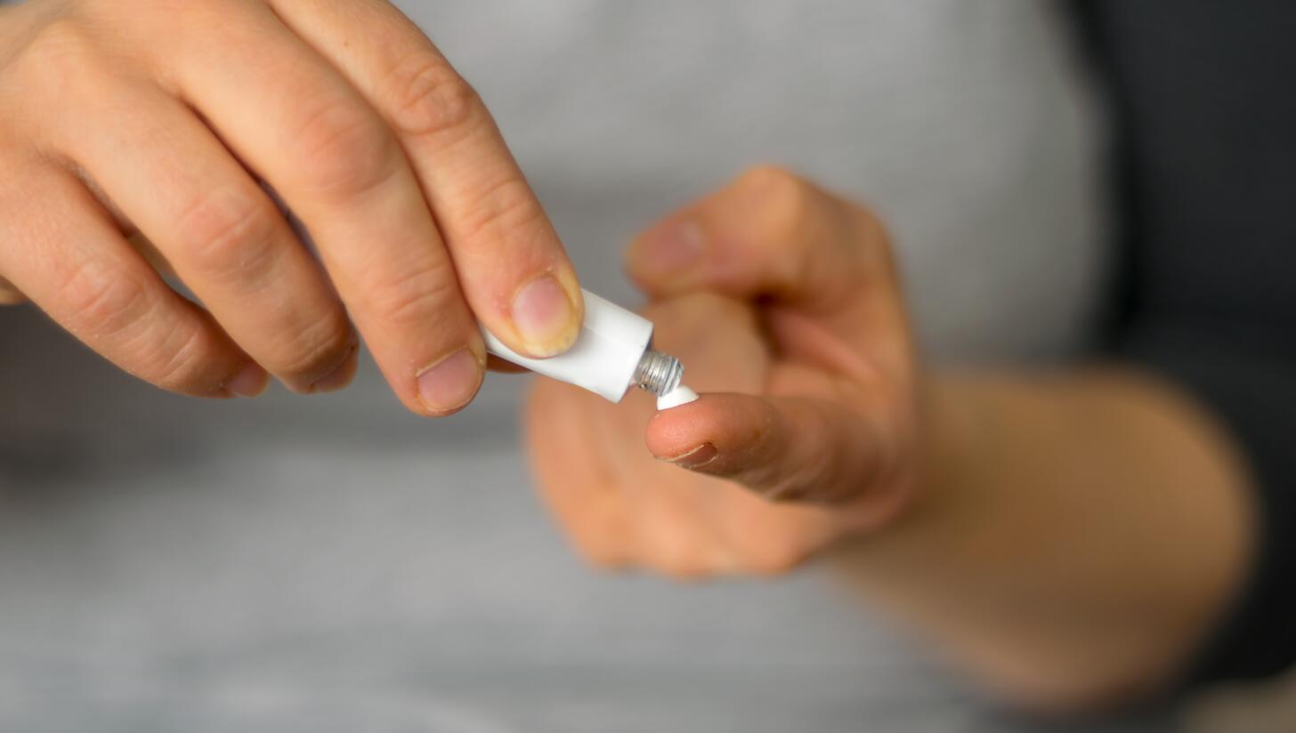 8 Surprising Uses for Hemorrhoid Cream