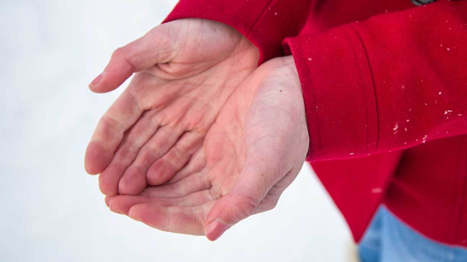 Frostbite: Symptoms, Treatment, and Prevention