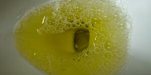 5 Fast Facts About Urine