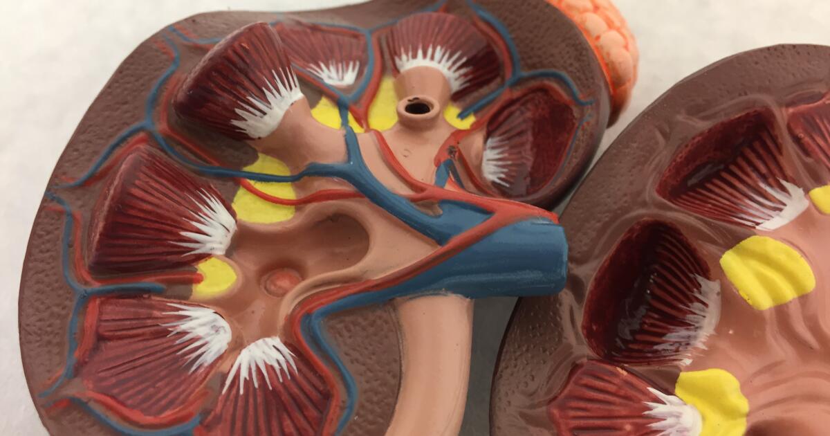 Kidney Transplant: How It's Done, Risks, What to Expect