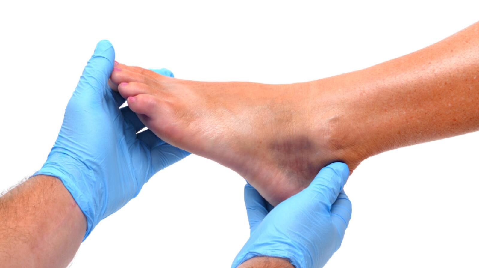 10 Reasons to See a Podiatrist