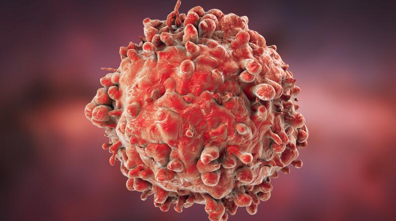 leukemia radiotherapy