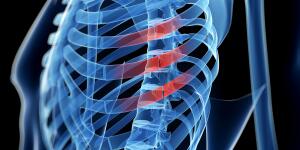 Most Painful Broken Bones